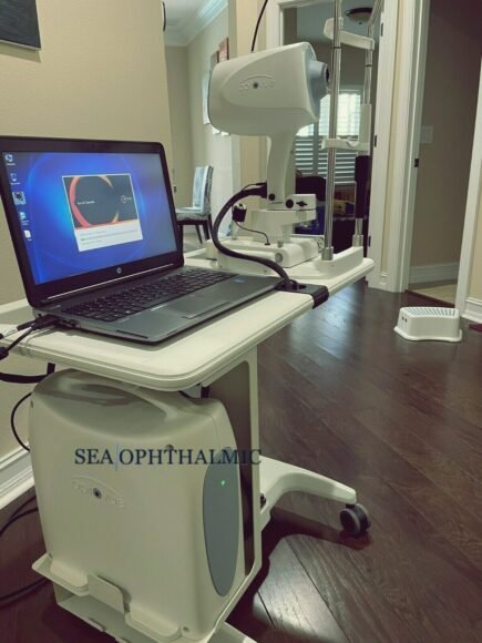 Optovue iVue 100 OCT Compact and Reliable Optical Coherence Tomography